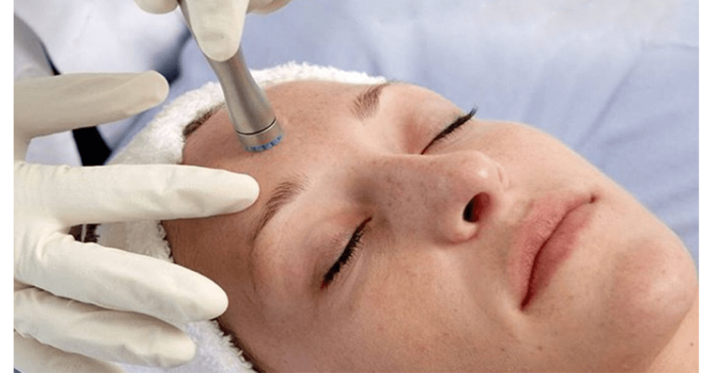 Skin Resurfacing - San Antonio & Boerne Dermatologist