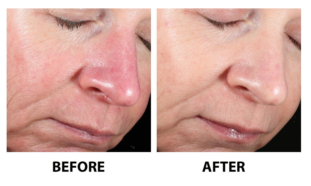 DermaV - San Antonio & Boerne Dermatologist